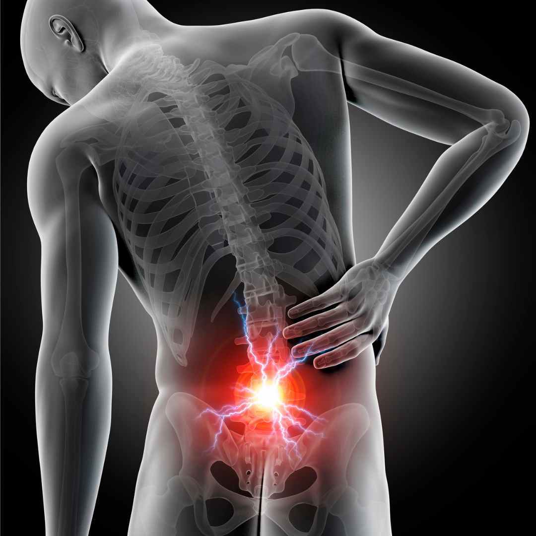 Lower Back Pain | ChiroHabit